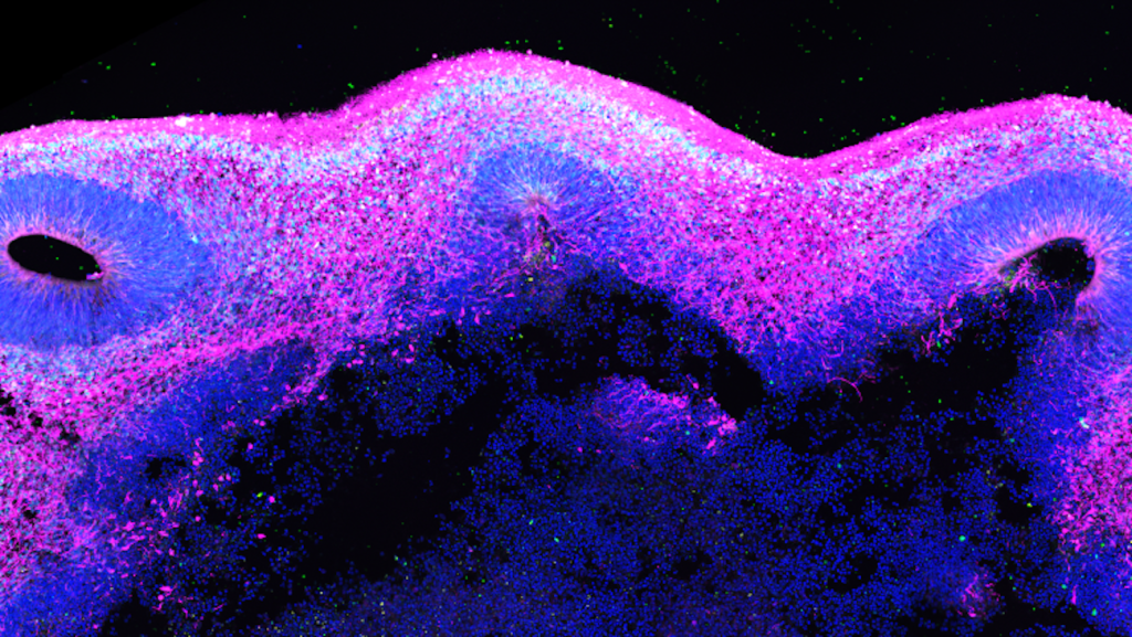 Research - UK Human Functional Genomics Initiative